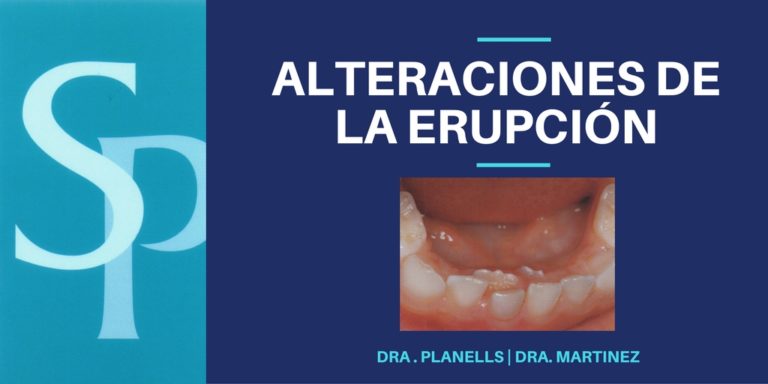 Alteraciones de la erupción – ClinicaSp